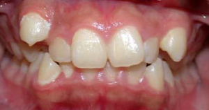 View Our Work - Greater Boston Orthodontics
