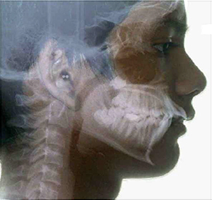 View Our Work - Greater Boston Orthodontics